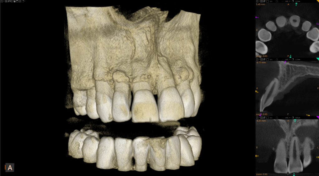 Cutting Edge Technology - Pafford Endodontics
